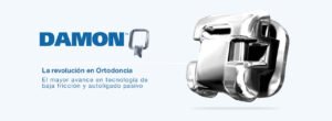 Damon Q - Ormco / Colombia Ortodoncia de la mejor calidad