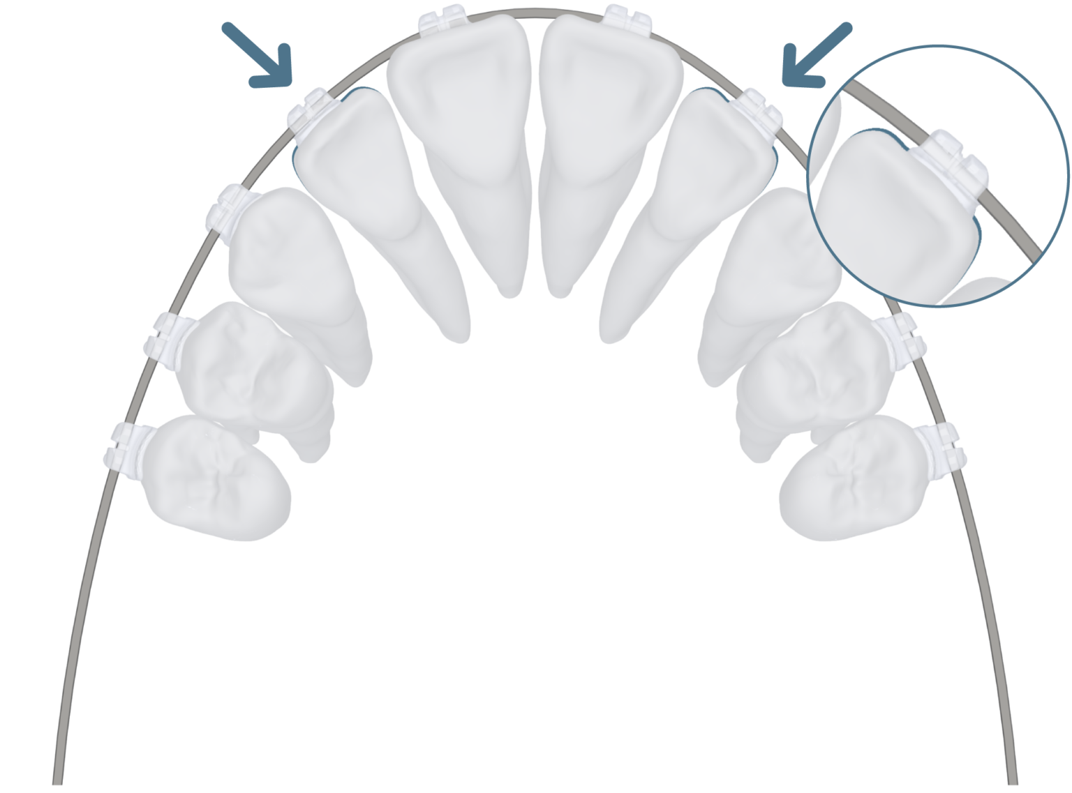 Symetri - Ormco / Colombia